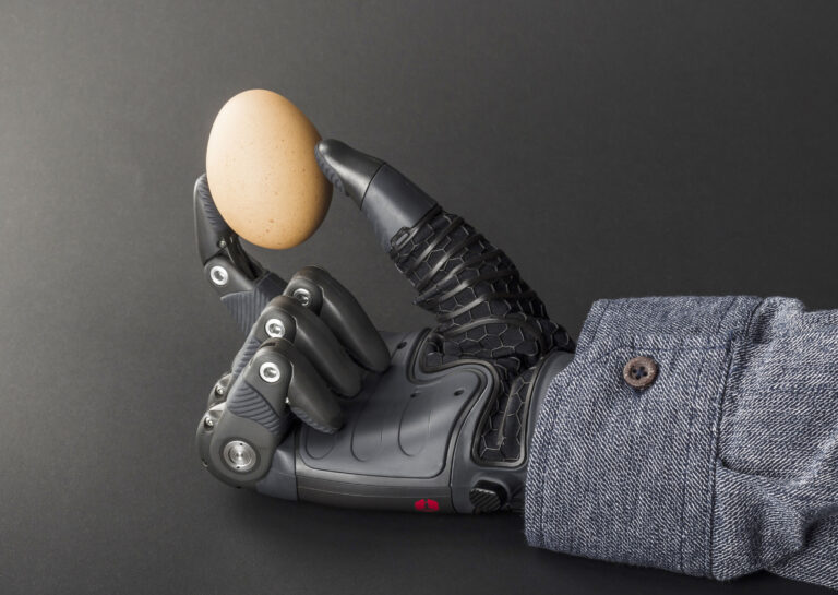 Upper-Limb Prosthetics: Passive, Body-Powered, Myoelectric & Pattern ...